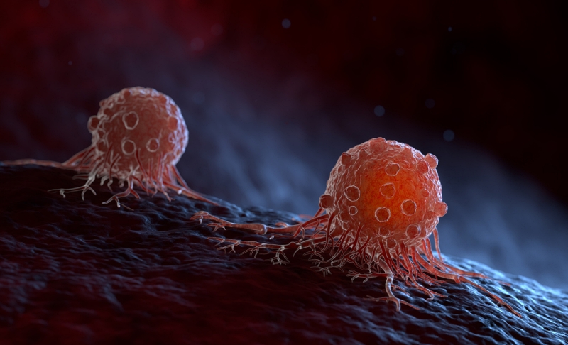 Study Finds Cancer Cells Use a New Fuel in Absence of Sugar - The Good ...